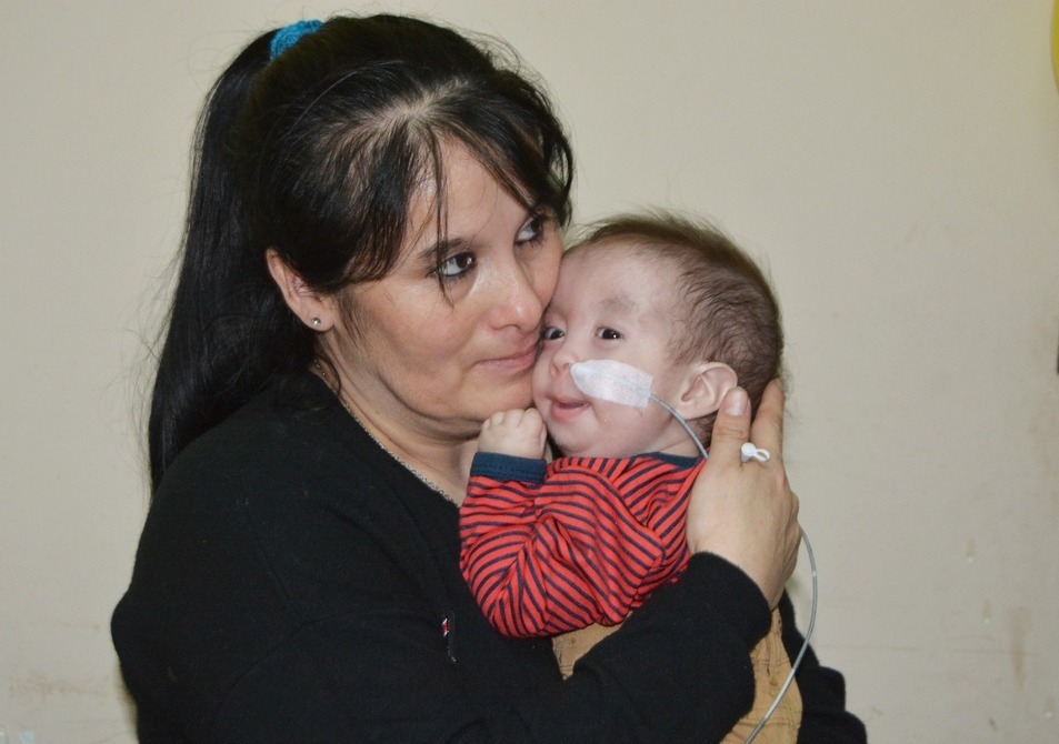 Confirman que van a operar a Oseías, el bebé con Síndrome de Edwards ...